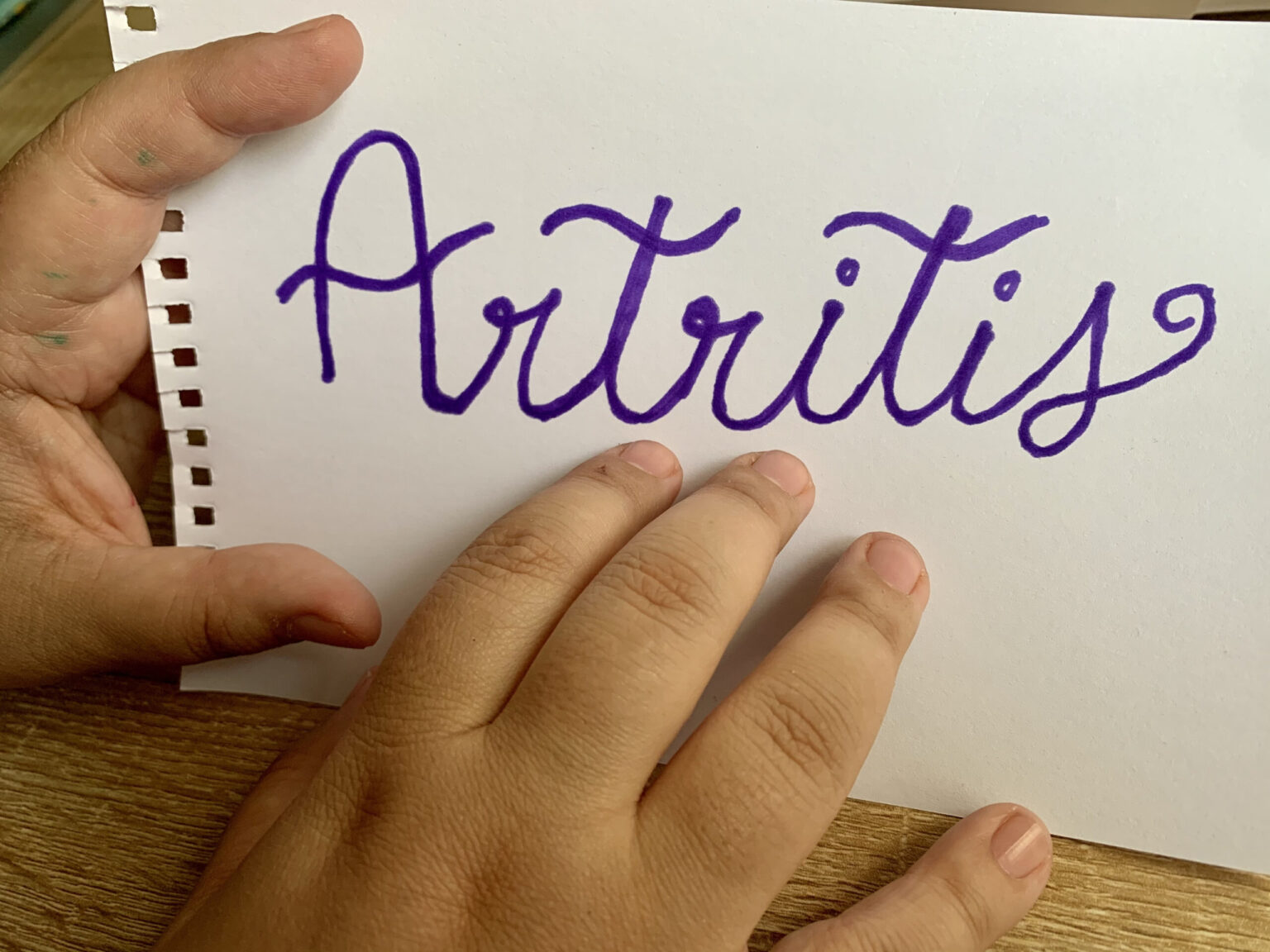 Does Arthritis Qualify for Disability?